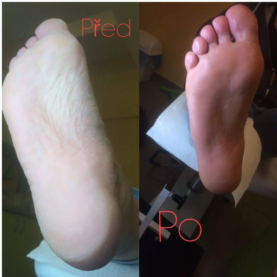 Salón Janet - Pedikúra